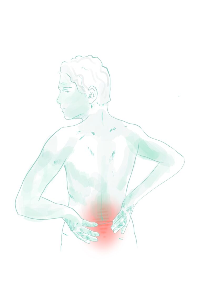 Symptome - Bandscheibenvorfall LWS - Bandscheibenvorfall LWS erkennen